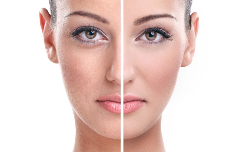 Things You Need To Know When Opting For A Facial Rejuvenation Treatment