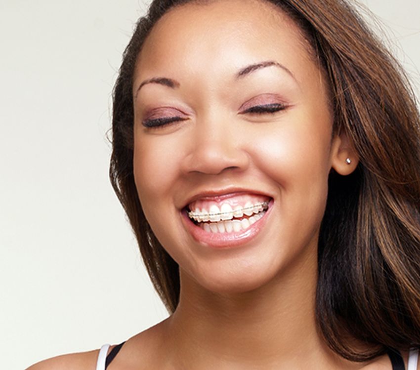 Smile With Confidence - What You Need To Know About Wearing Braces